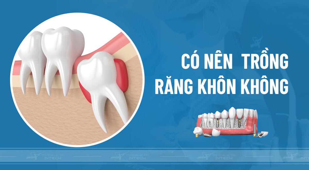 Trồng răng khôn(răng số 8) thực sự cần thiết không? Bác sĩ giải đáp